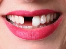 Teeth and Healthy Eating Class Assembly | Teaching Resources