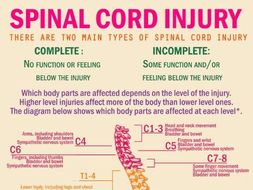 Spinal Cord Injury Poster | Teaching Resources