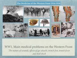 GCSE History of Medicine. WW1. The main medical Problems of the Western ...